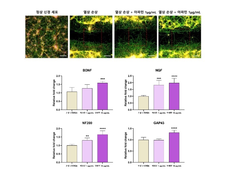 [건강]꿀벌 봉침 속 ‘아파민’ 성분 척추∙신경세포 재생 효과 입증