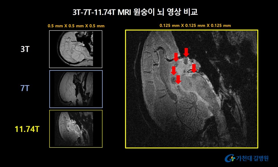 세계 최초 11.74T MRI로 원숭이 뇌 영상 촬영 성공..치매, 파킨슨 기전 규명 선도