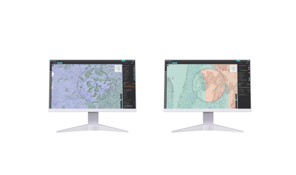[AI의료]루닛, 글로벌 제약사 분석 의뢰 5000 건 돌파 外 아이젠사이언스·강북삼성병원